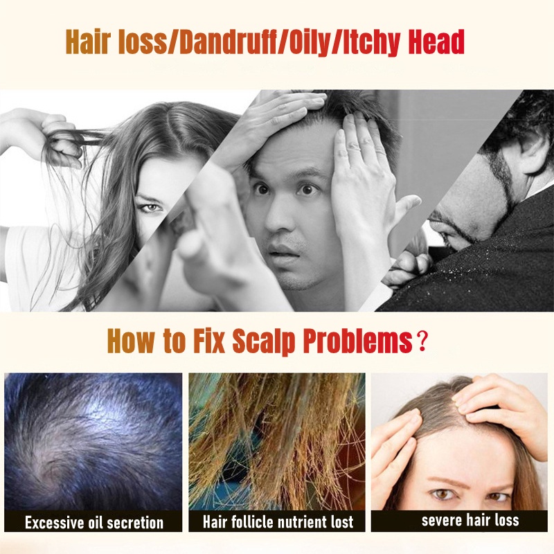 AZLA Ginger Hair Shampoo Fast Regrowth Hair Thick Anti-Hair Loss Anti ...