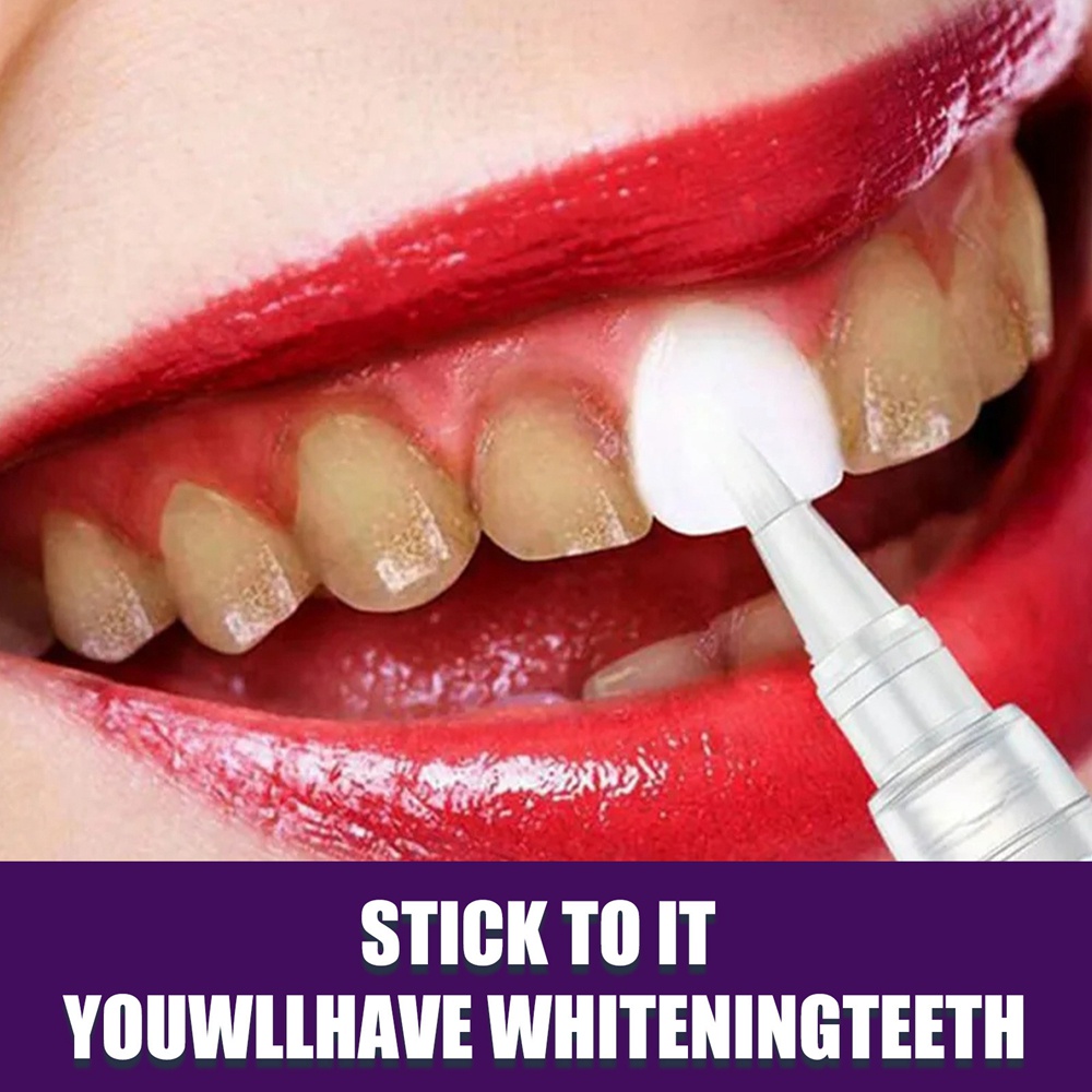 Teeth Whitening Pen Repair Bright White Anti-Sensitive Remove Smoke ...