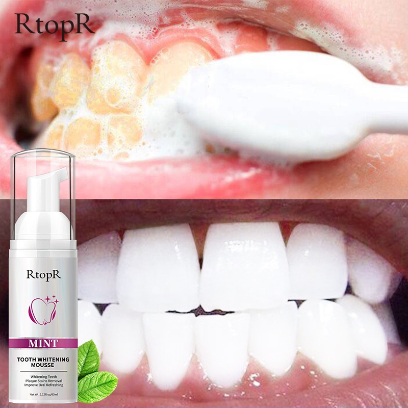 RtopR Teeth Cleansing Whitening Mousse Removes Stains Teeth Whitening ...