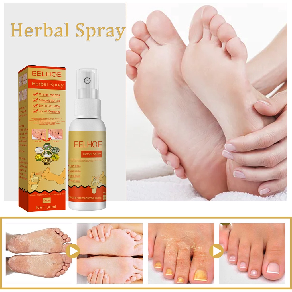 EELHOE Fungal Combat Feet Spray Relieve Itching Blisters Beriberi ...