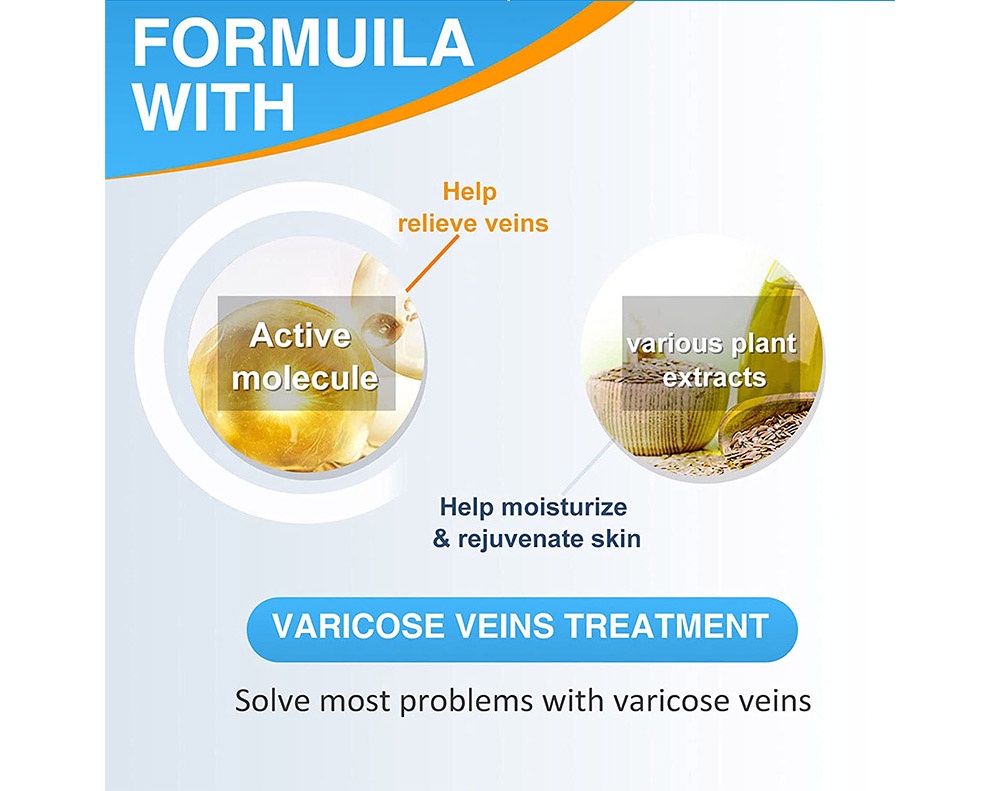 varicose veins effective remover cream varicose vein remover cream and ...