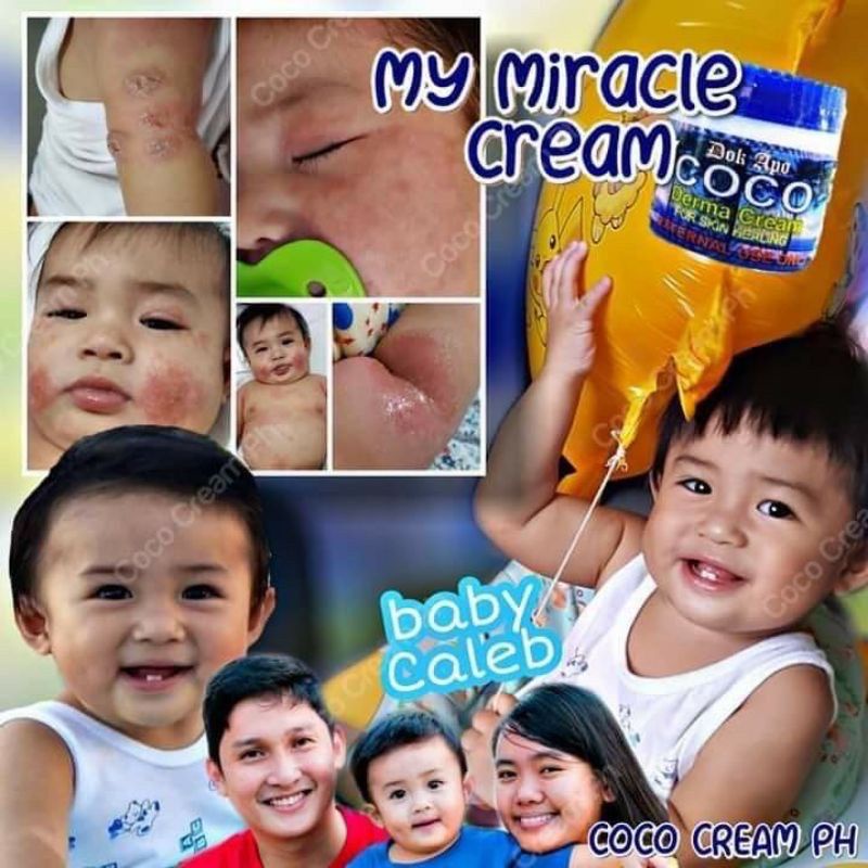 COCO DERMA CREAM DOK APO FOR ALL SKIN PROBLEMS | Shopee Philippines