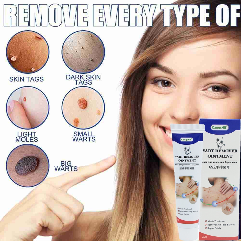 Wart Treatment Cream Wart Removal Ointment Neck Skin Tag Armpit Flat ...
