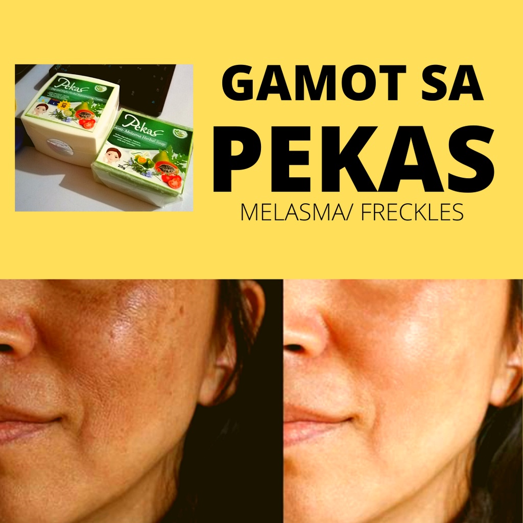 Pekas Soap and Cream | Shopee Philippines