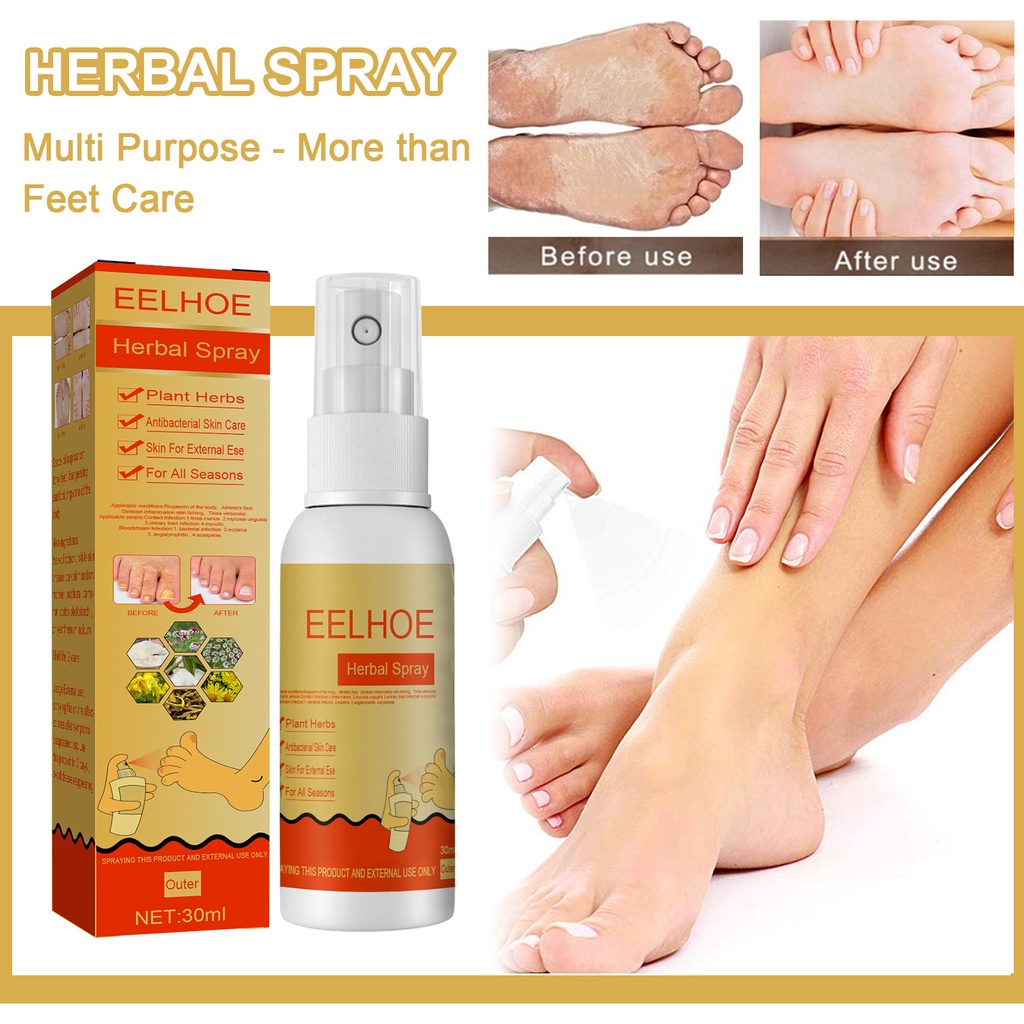 EELHOE Fungal Combat Feet Spray Relieve Itching Blisters Beriberi ...