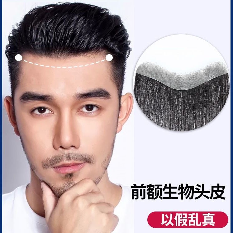 Hair Line Wig Sticker Forehead Men High Forehead Men Bald Top Wig Piece ...