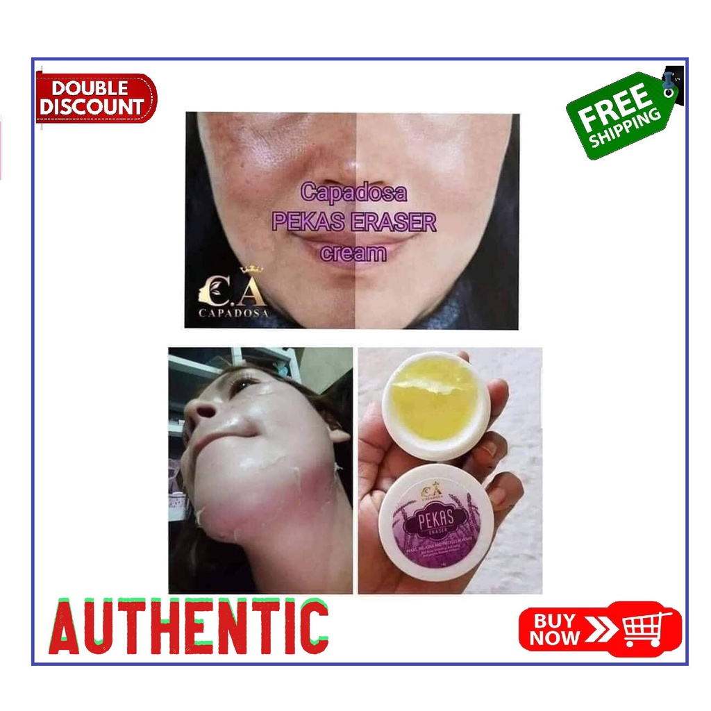 CAPADOSA|PEKAS Eraser|PIMPLE ERASER Super Effective for Melasma at ...