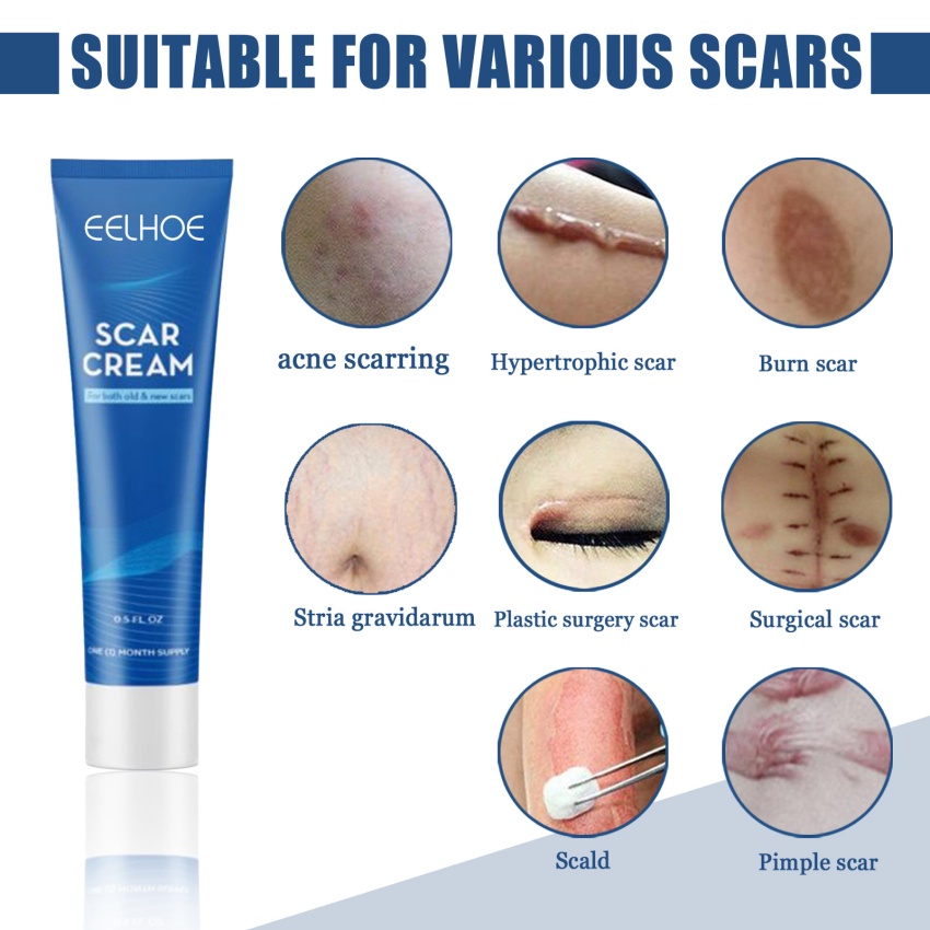 Scar Repair Cream Scar Removal Ointment Reduce Scar Area Fade Scar ...