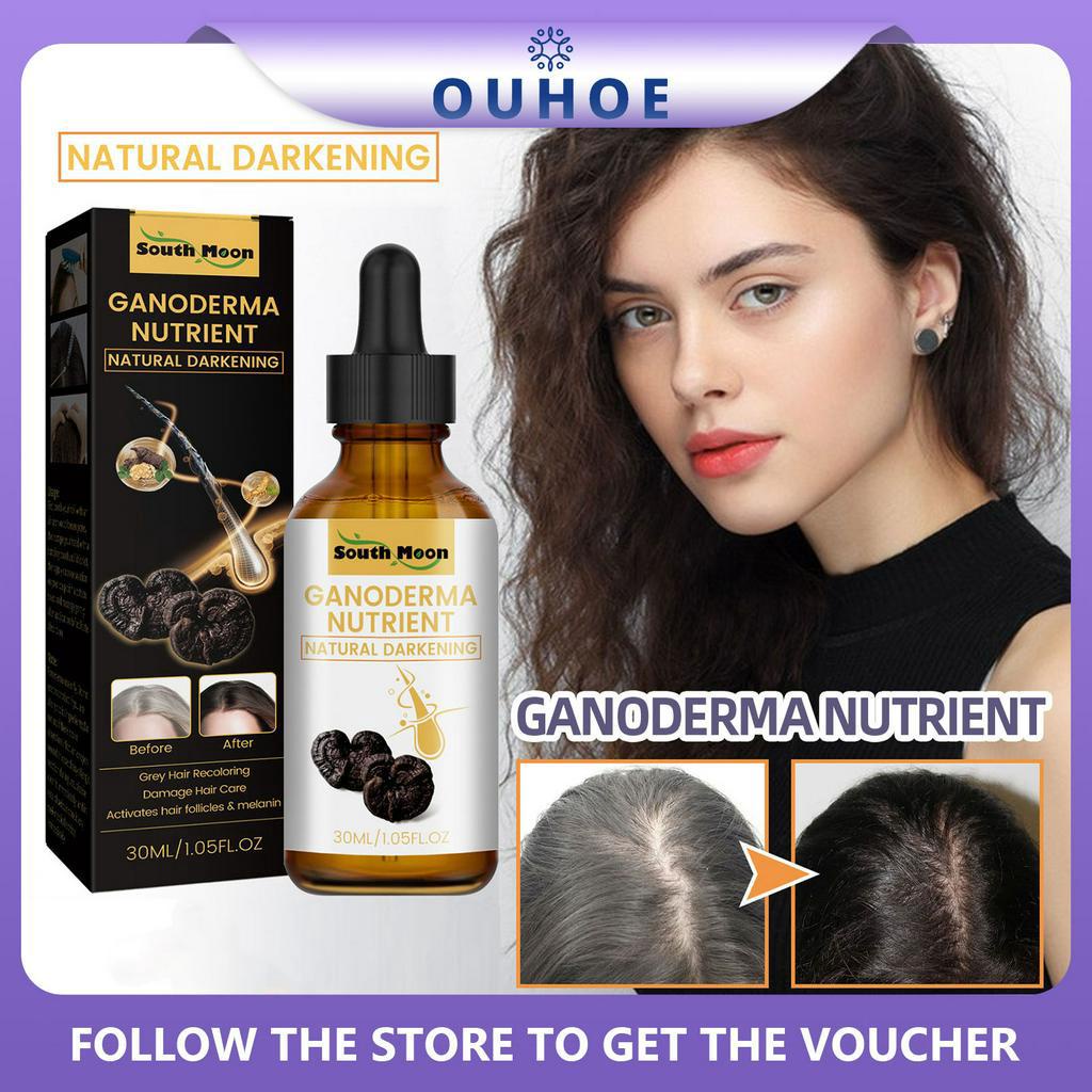 Blackening Hair Dye Serum 30ml White Hair to Black Hair Anti Hair loss ...