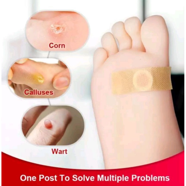 Breadmaxine 18 Patches Corn Remover Kulugo Alis Wart Remover No Pain ...