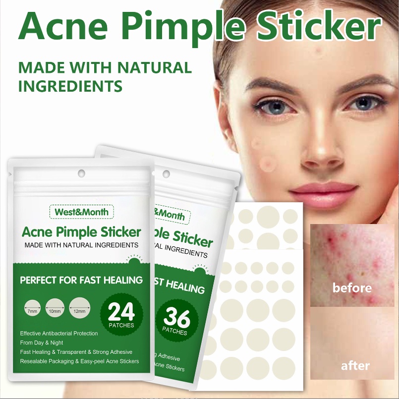 Acne Pimple Sticker Invisible Concealer Liquid-absorbing Acne Patch ...
