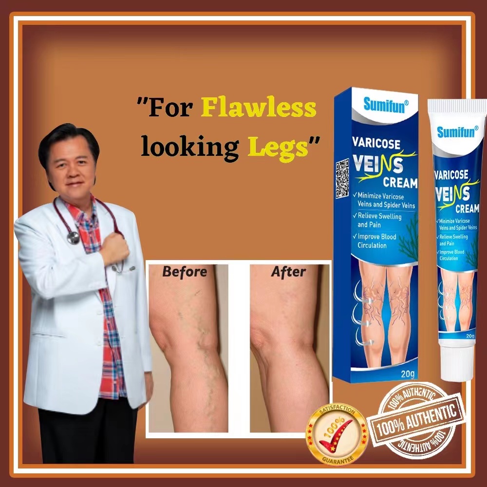 100% effective Varecose vein ointment Intravenous cream varicouse ...