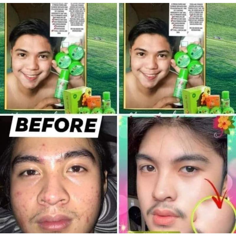 Authentic Ayesha Mild Rejuvenating Set | Shopee Philippines