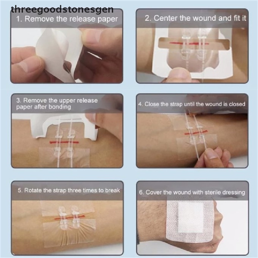 [threegoodstonesgen] 2PC/box Bandage Band Aid Zip Stitches Zip Tie ...