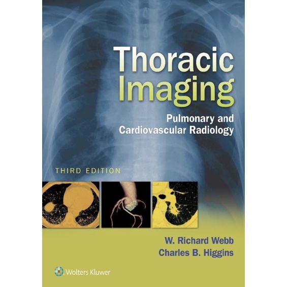 Thoracic Imaging: Pulmonary and Cardiovascular Radiology 3rd Edition ...