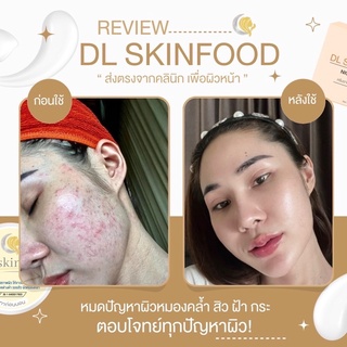 DELI SKIN NIGHT CREAM FOR ACNES/MELASMA/ DULL SKIN FROM THAILAND (5g ...