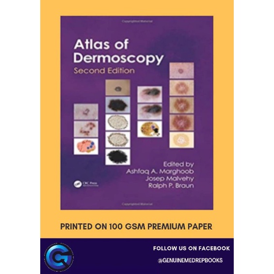 ATLAS OF DERMOSCOPY 2ND EDITION | Shopee Philippines