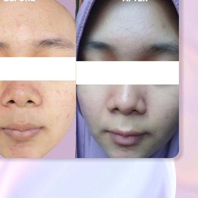 Airnderm Aesthetic Sunscreen Sensitive Tube SPF 30 (by AIRIN BEAUTY ...