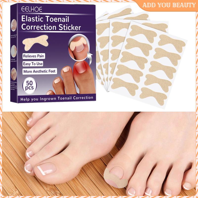 Toenail Corrector Glue Toenail Care Tool Ingrown Toenail Sticker for ...