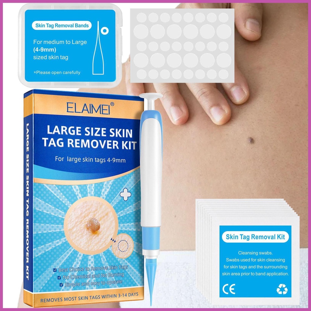 Wart Remover Pen Upgraded Skin Tags & Moles Removal Kit Simple Painless ...