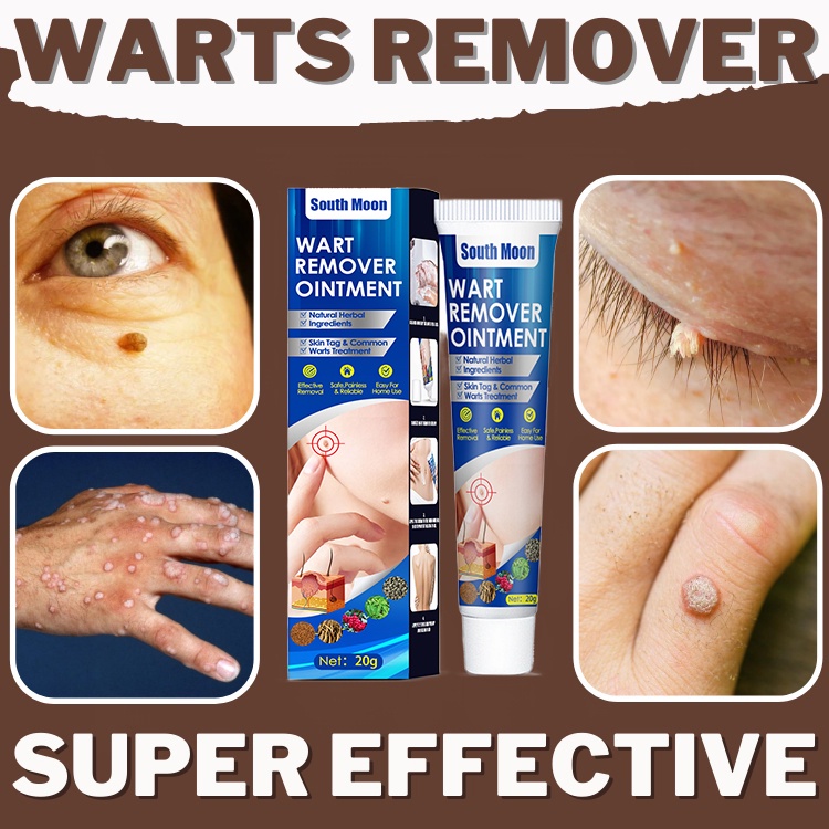 Warts remover original Kulugo Remover cream Skin Tag Remover Natural ...