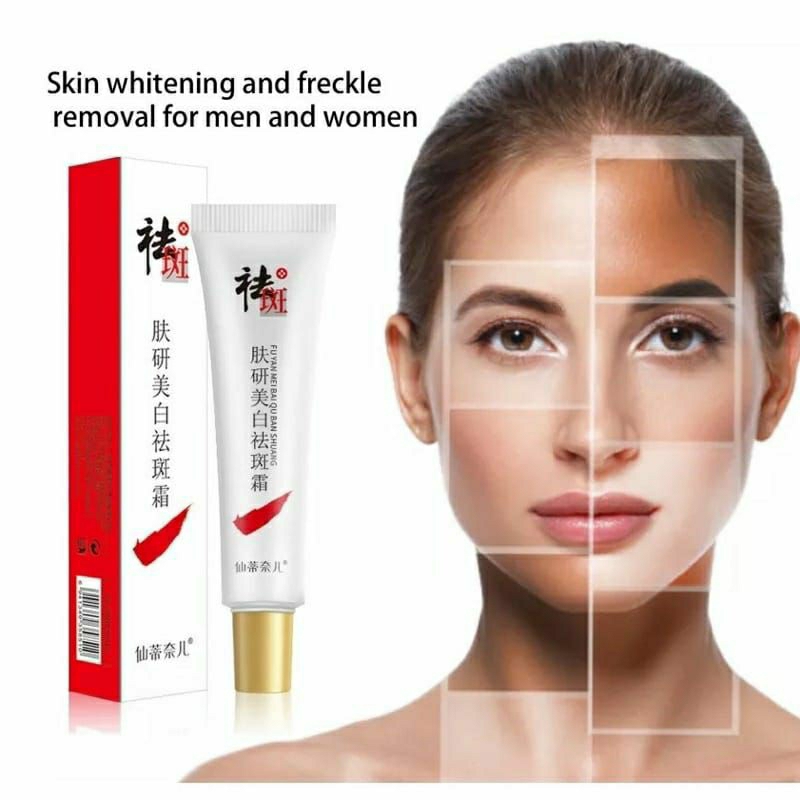 HITAM Viral CINDYNAL Medicine CREAM Removing Black Spots Acne Scar ...