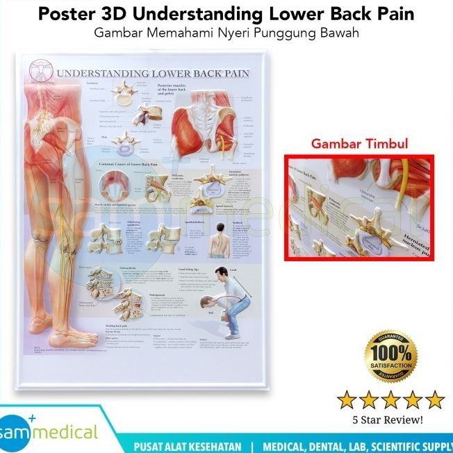 Poster Understanding Lower Back Pain (3D) BS 170 / Image in a embossed ...