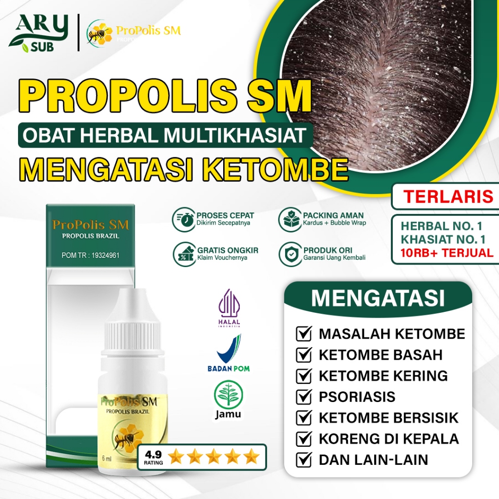 Dandruff Medicine, Severe Dandruff, Hair Dandruff, Crusty Scalp, Scaly ...