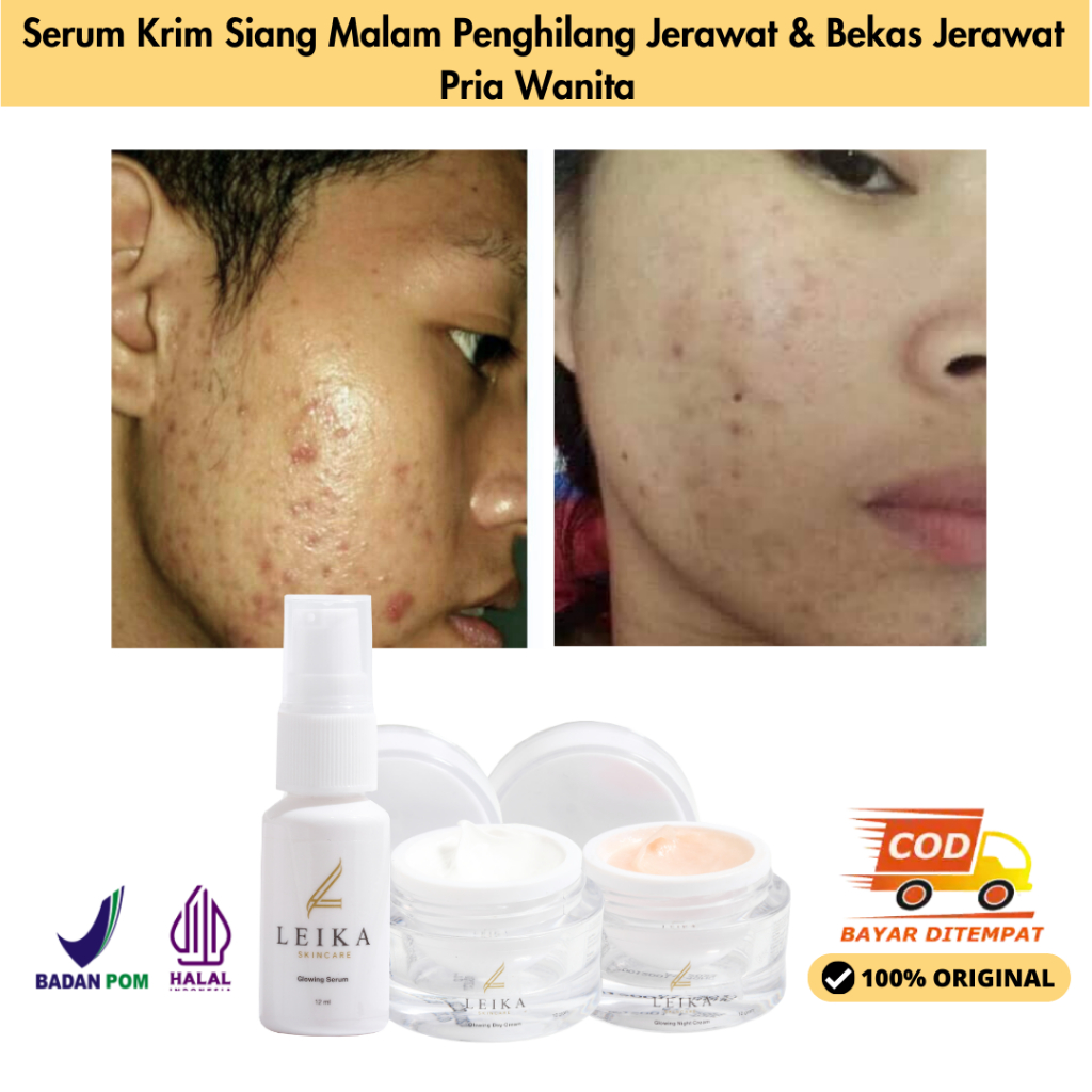 Package Of 3in1 Day Cream, Night Cream And Serum Removing The Most ...