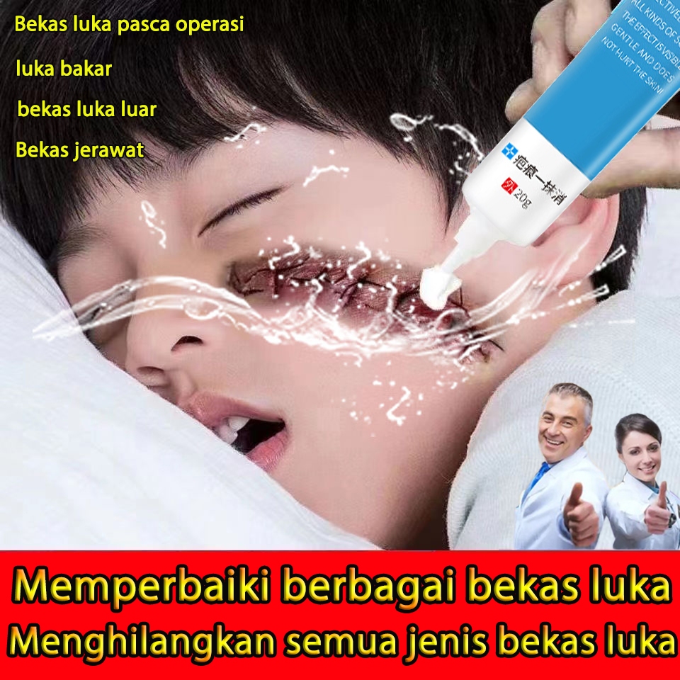 HITAM Scar Removal Acne Spots Smallpox Allergies Itching Mosquito Bites ...