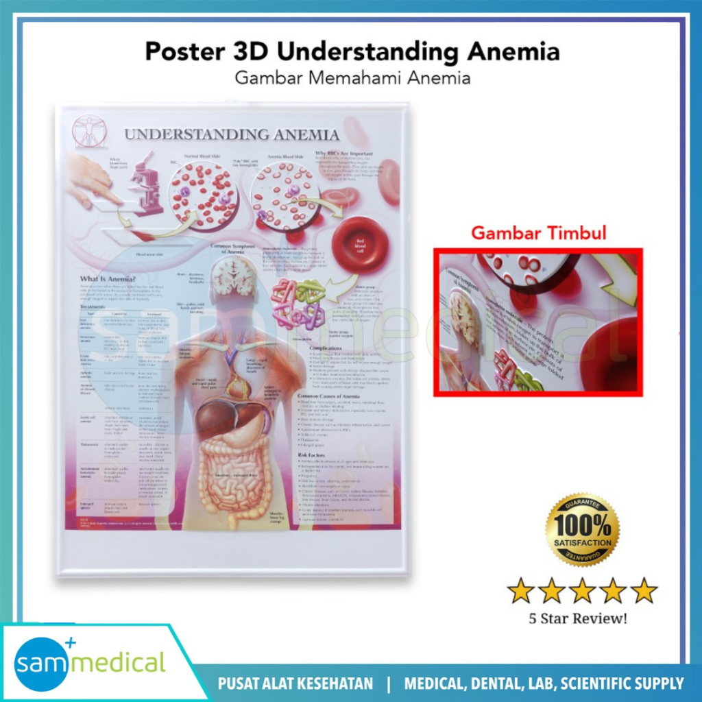 3D Understanding Anemia poster / poster Image of Understanding Anemia ...