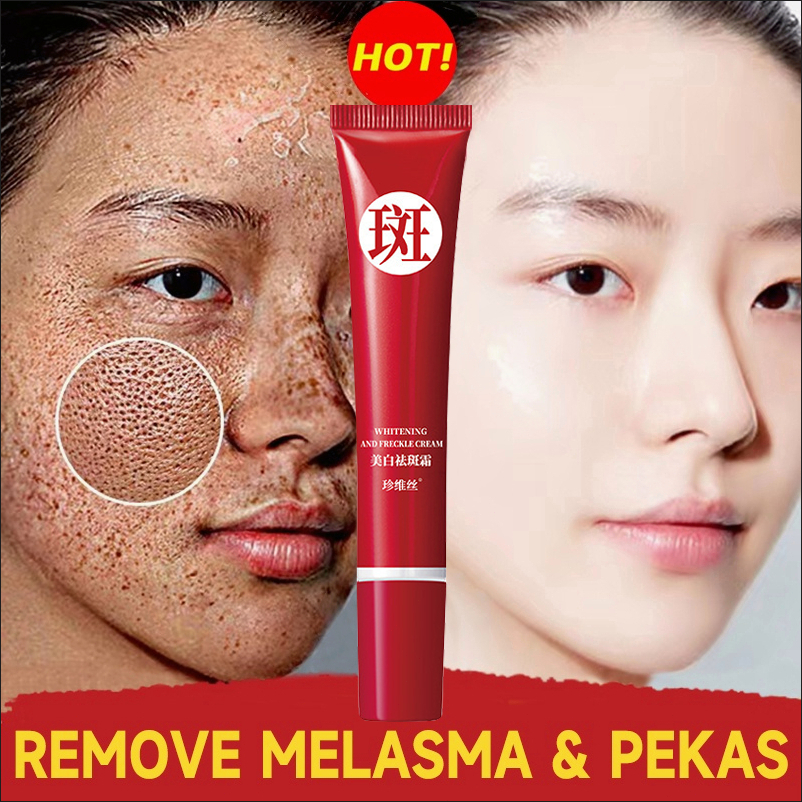 HITAM Black Spots Remover Cream To Remove Black Spots On The Face ...