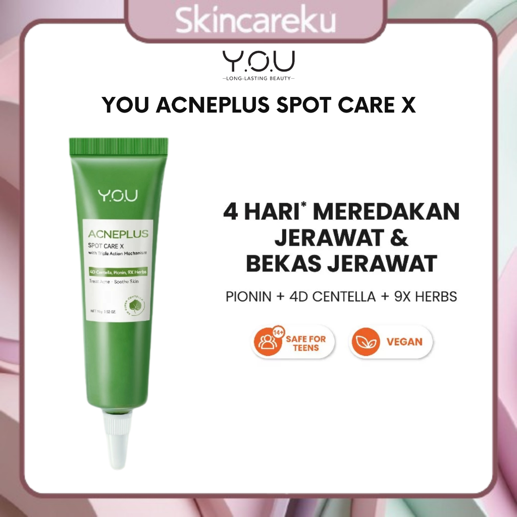 You Acne Plus Spotcare X With Triple UV Mechanism - Acne Spot Treatment ...