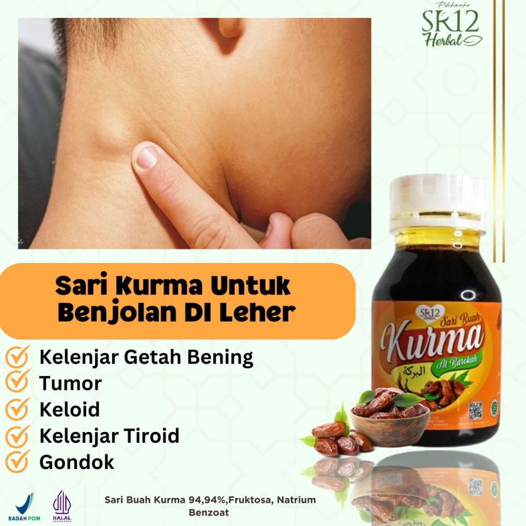 Medicine For Lumps In The Neck Medicine For Lumps Lipoma Lumps Uci ...