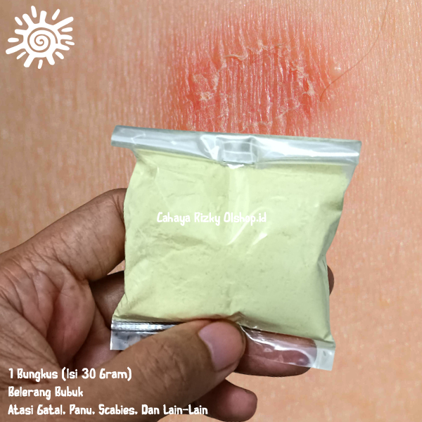 Original sulfur sulfur powder 30 grams of tinea versicolor and ...