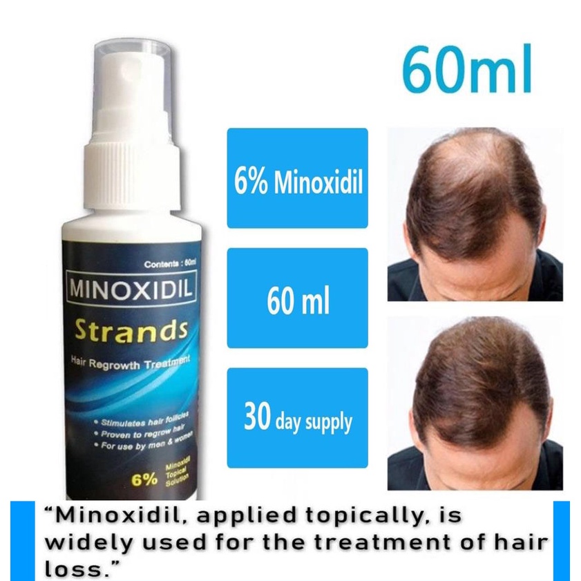 Minoxidil shares a 6% hair growth spray minoxidil topical solution ...