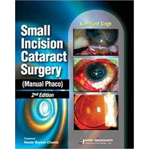 Small Incision Cataract Surgery (Manual Phaco) | Shopee Philippines
