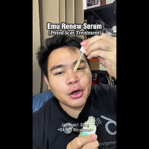Dermalab Emu Renew Serum, Pitted Scar Treatment Serum, Safe for Skin ...