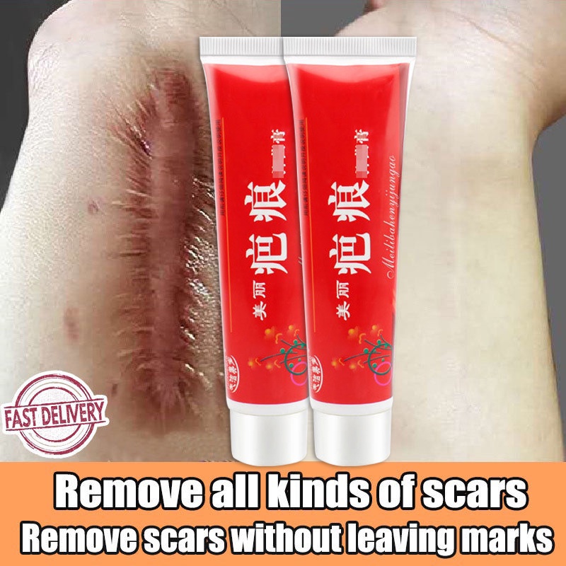Scar Removal Cream Peklat Remover Acne Scar Treatment Old Scar Remover ...