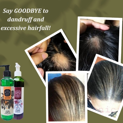Zivine Organics Anti Hairfall, Anti Dandruff and Hairgrower Shampoo ...