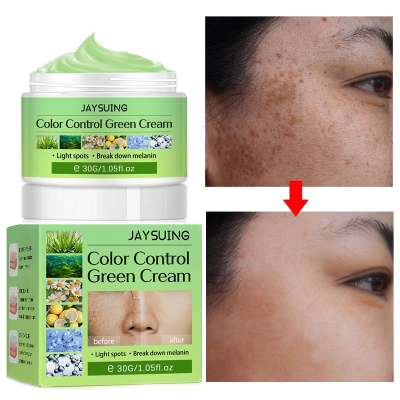 Jaysuing Whitening Freckles Cream Remove Melasma Dark Hyperpigmentation ...