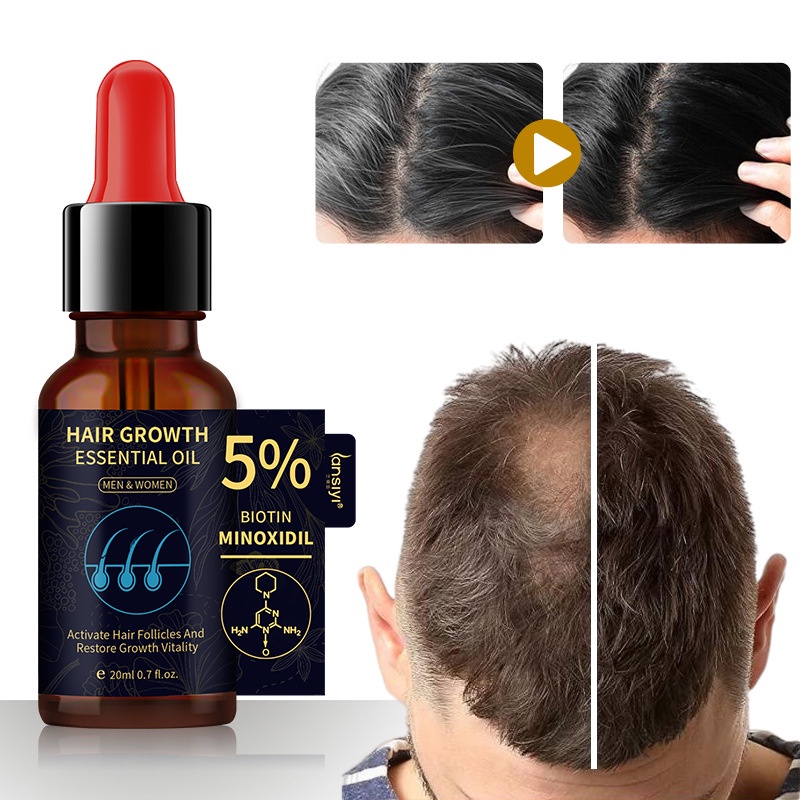 Minoxidil Hair Grower Topical Solution Ginger Fast Hair Growth Serum ...