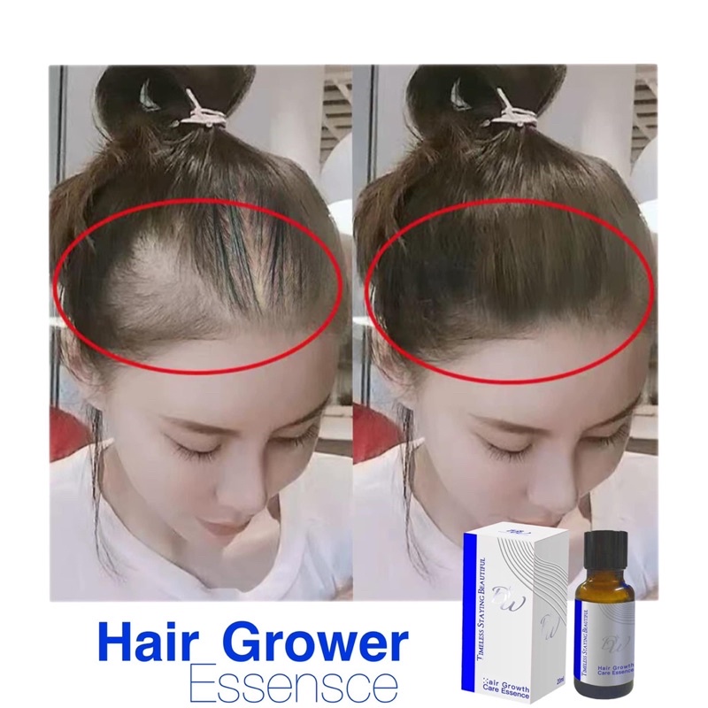 DW Hair Grower Fast Power Full Hair Growth Essence Hair Treament ...