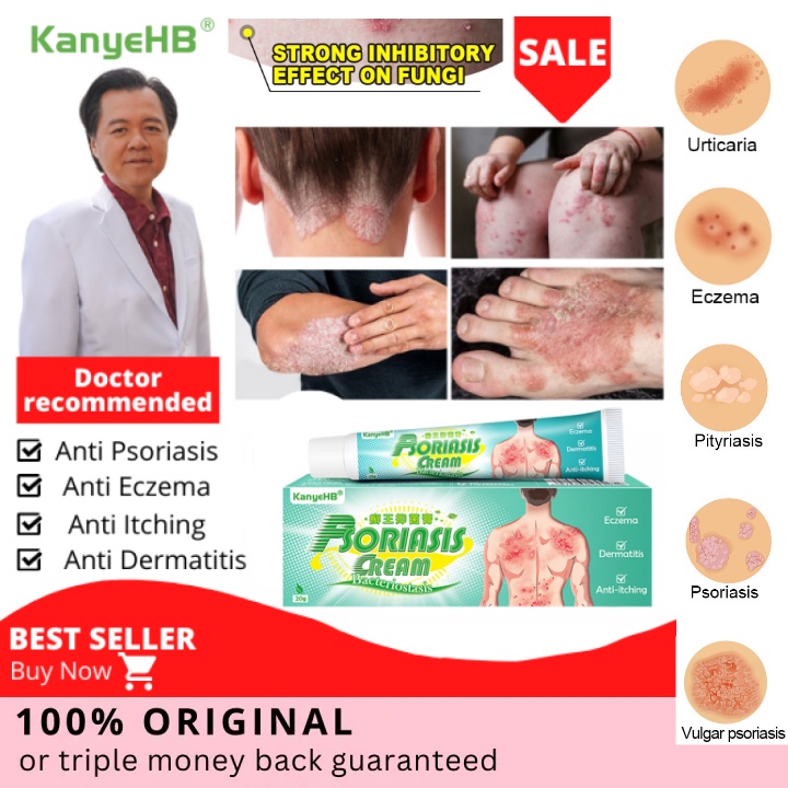 KANYEHB Psoriasis Cream Dermatitis Eczematoid Eczema Pruritus Ointment ...