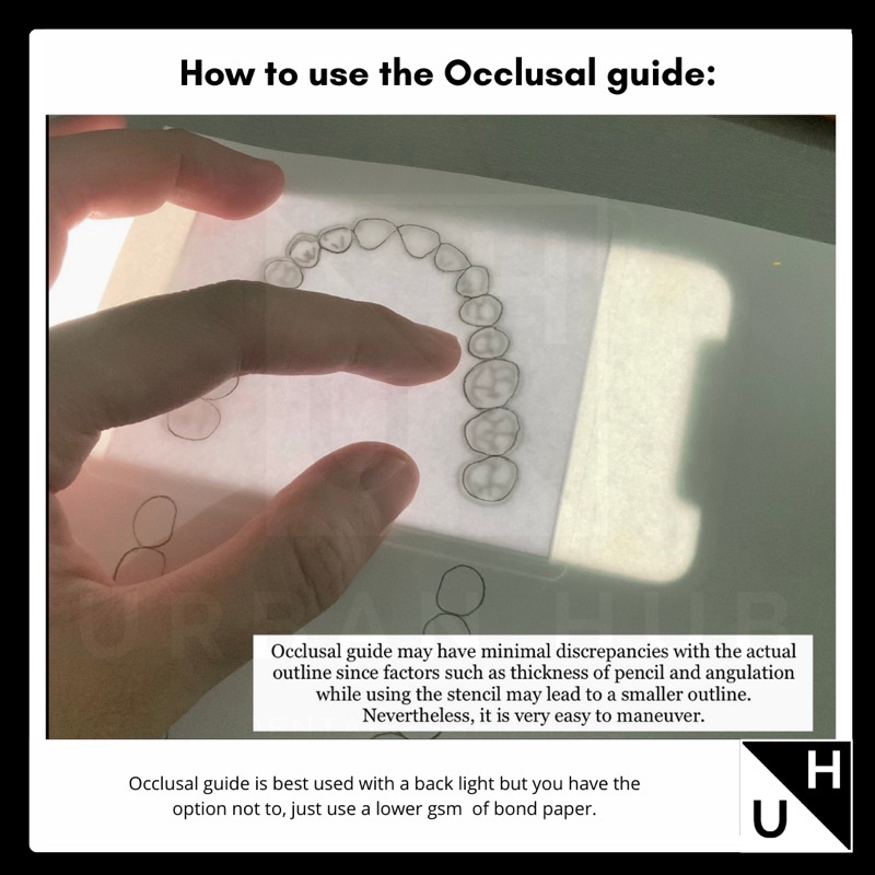 MULTIPURPOSE DENTAL ARCH TRACER STENCIL FOR RPD DESIGNING OCCLUSION ...