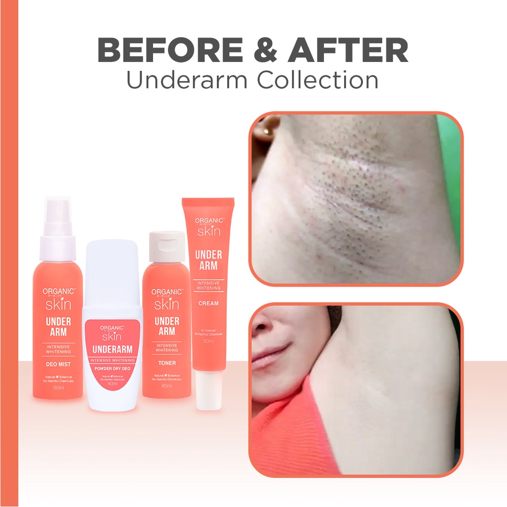 Organic Skin Japan Intensive Underarm Whitening Collection Under Arm ...