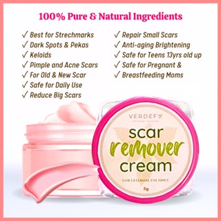 Keloid & Stretch mark Remover Cream Scar Remover Cream MIRACLE CREAM ...