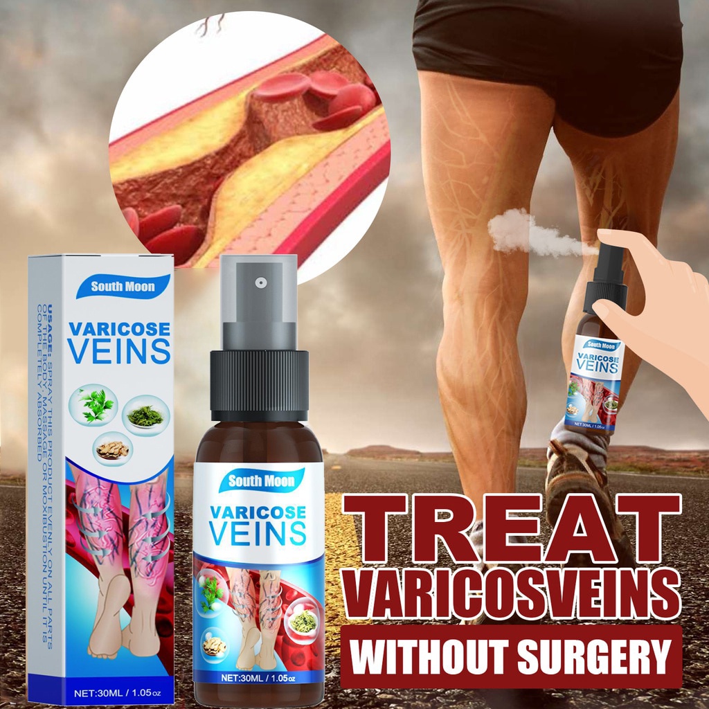 Varicose Veins Remover Veins Spray Spider Vein Pain Relief Varicosity ...