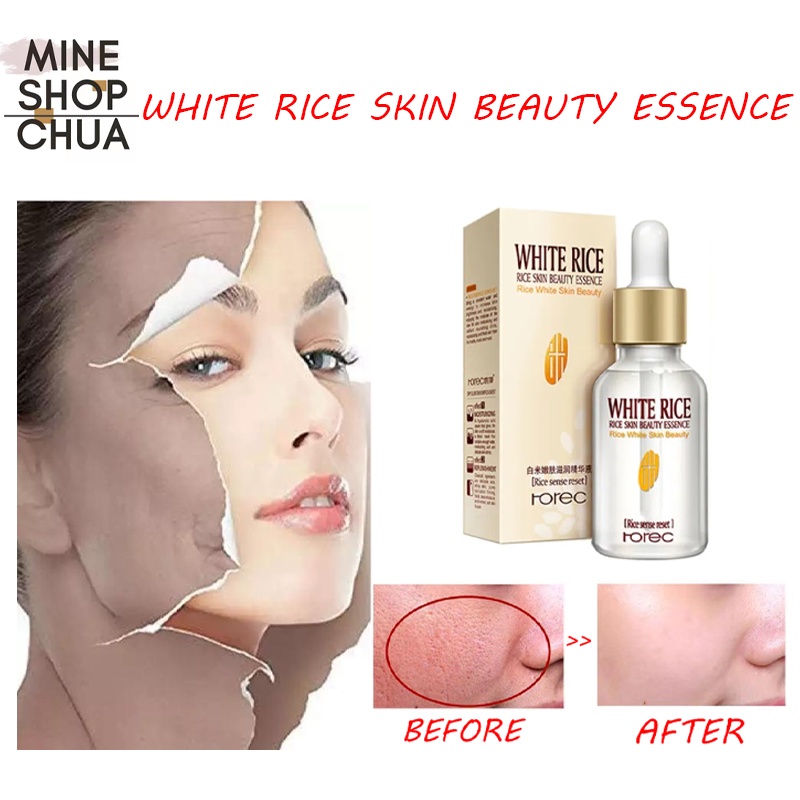 SUNISA Rice White Skin Beauty Serum 15ml | Shopee Philippines
