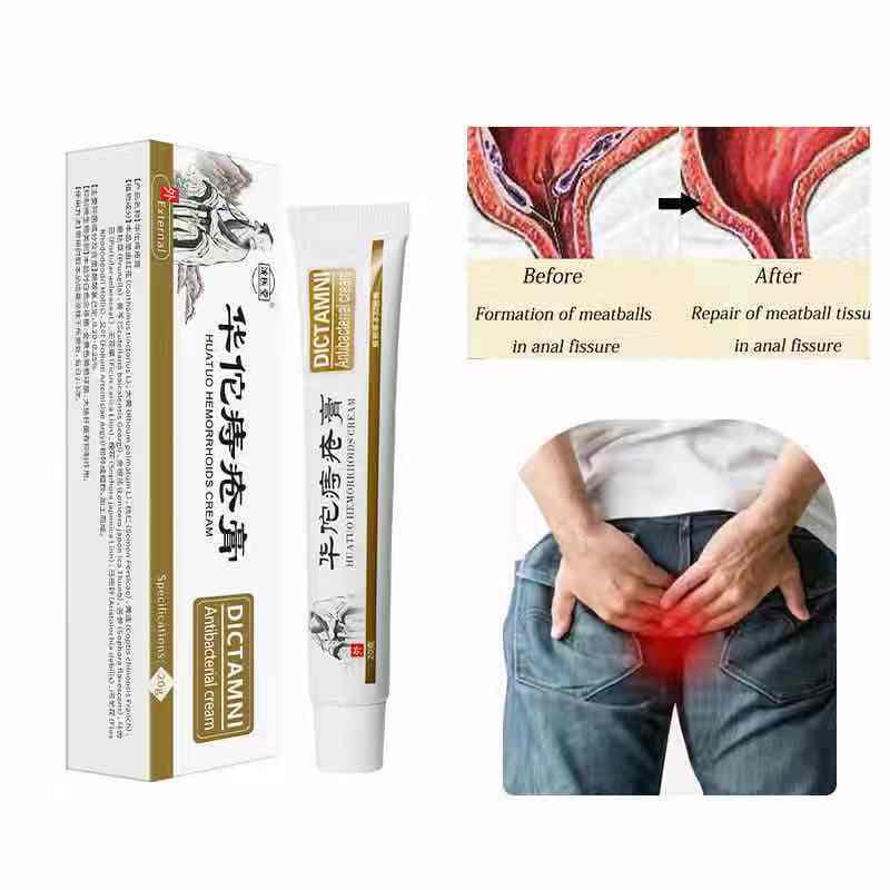 Huatuo Dictamni Hemorrhoid Ointment Antibacterial Cream 20g | Shopee ...